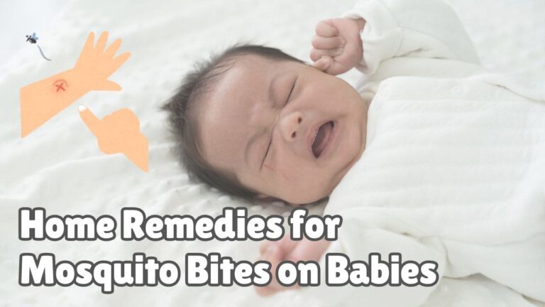 8 Home Remedies to Treat Mosquito Bites in Babies